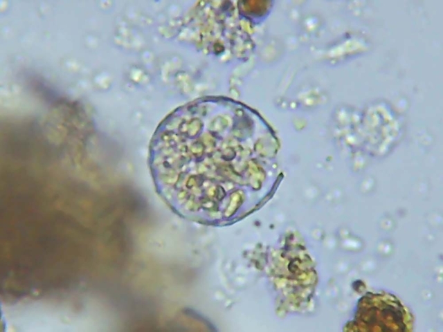 The Microscopic World of Soil | Denver Botanic Gardens